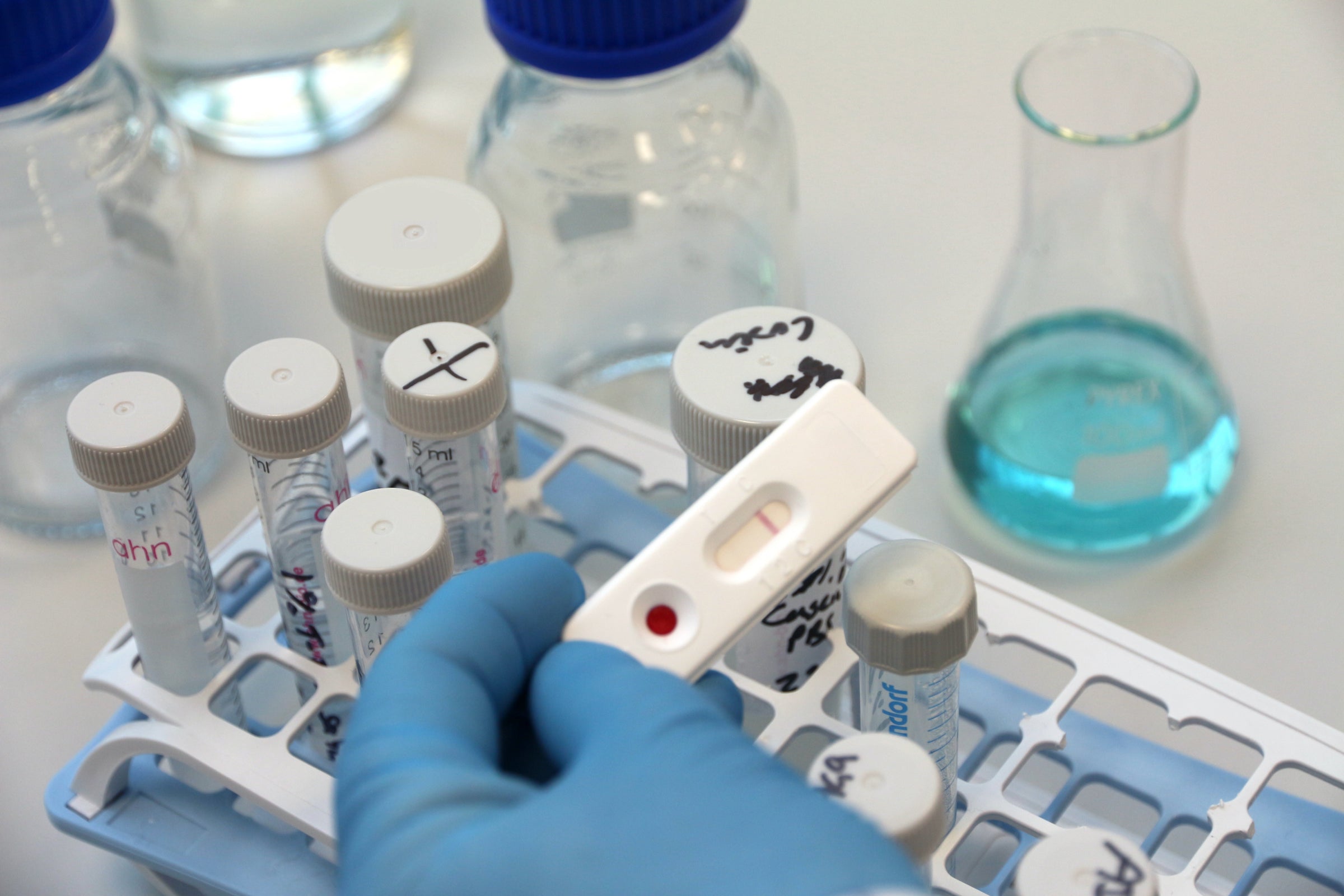 SELFCHECK Self-Testing Kits | Official UK Site